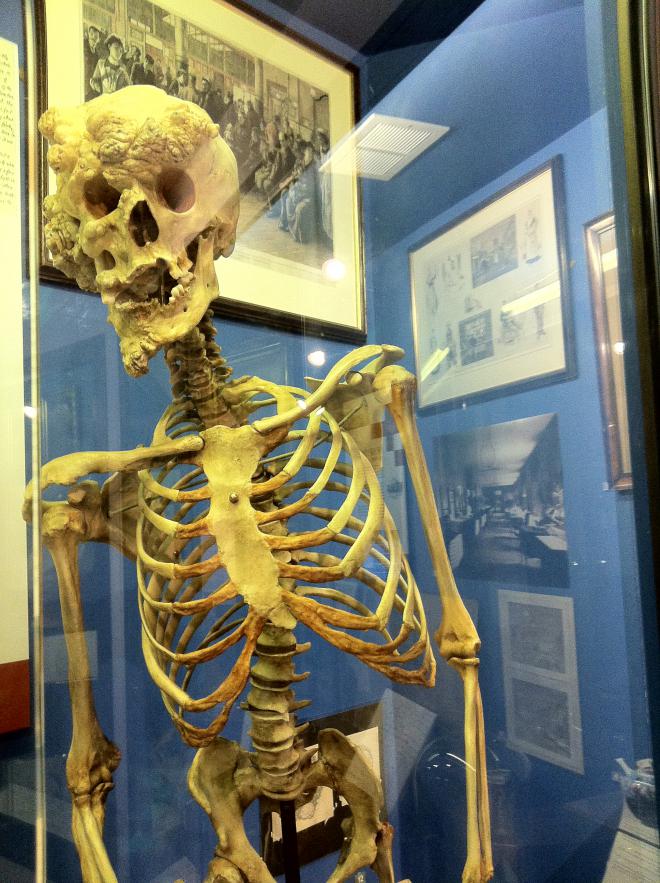 Joseph Merrick Net Worth 2024: Wiki Bio, Married, Dating, Family ...