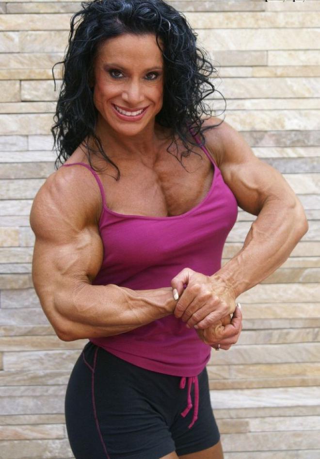 Debbie Bramwell Implants